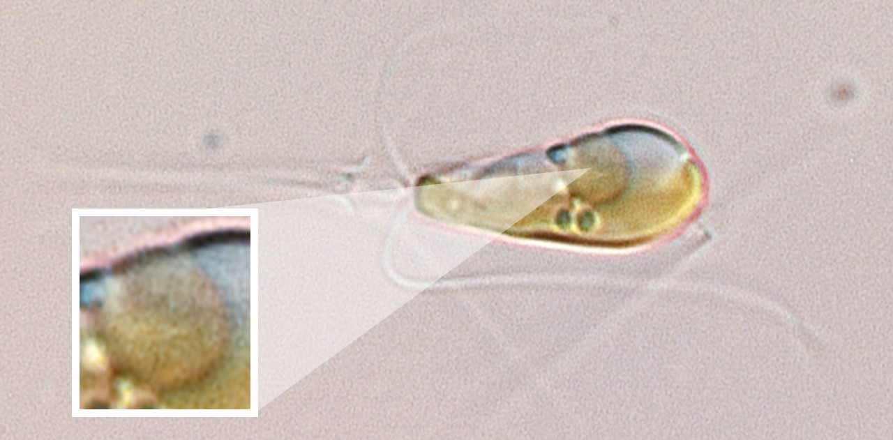 Nitroplasto: un importante hallazgo en evolución celular y biología de ...
